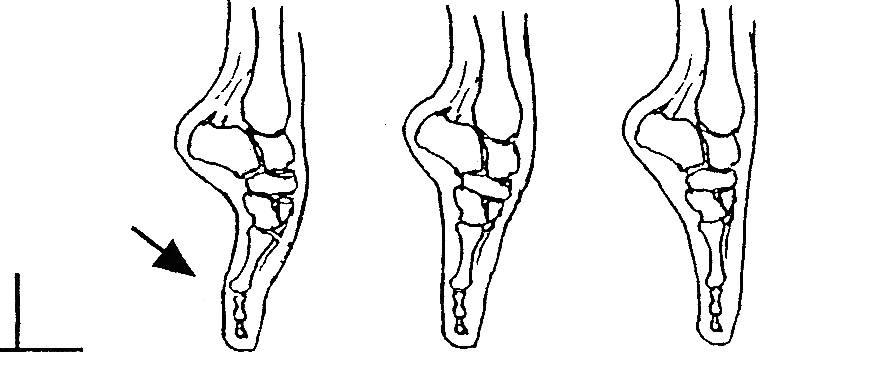 Guidelines for Starting a Student on Pointe - The Ballet Source - The ...